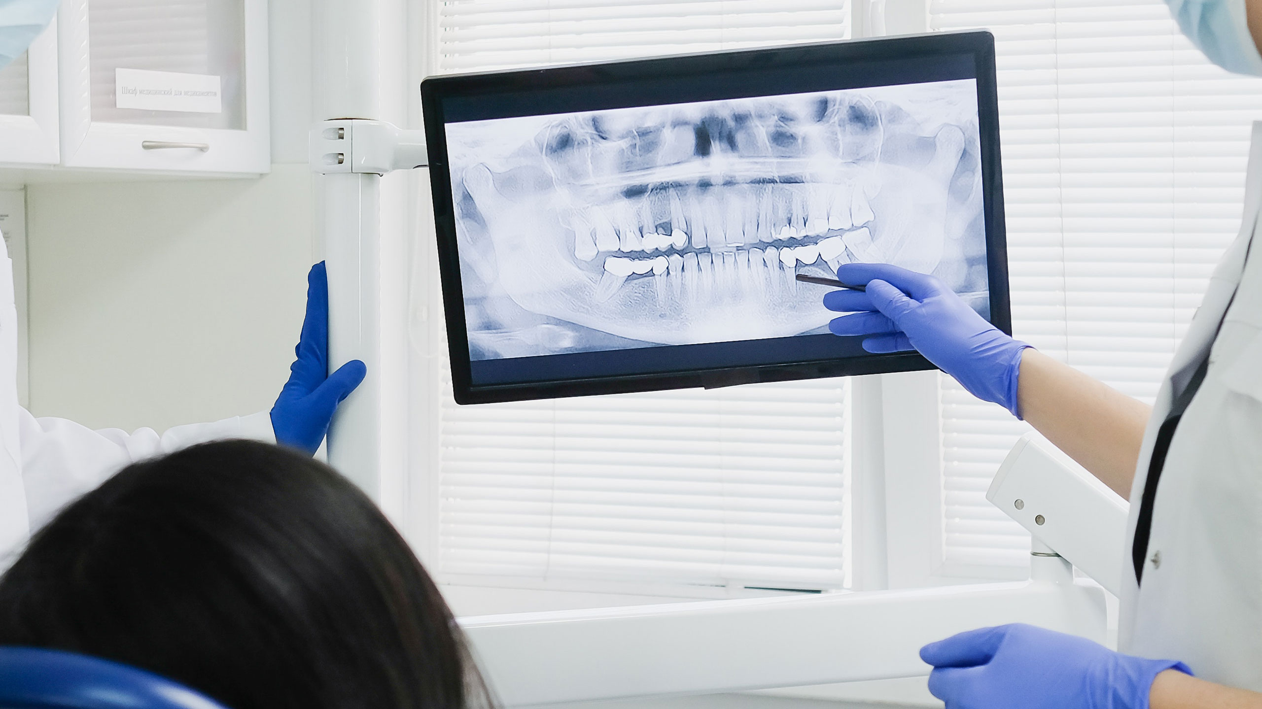 Digital X-Rays - Alkass Dental